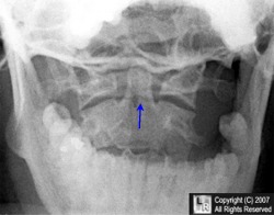 Untitled Document [www.learningradiology.com]