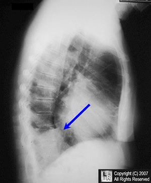 Untitled Document [www.learningradiology.com]