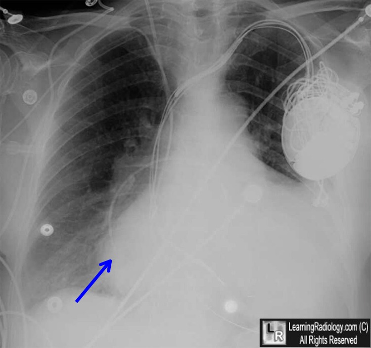 LearningRadiology