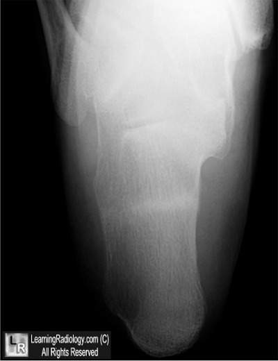 Welcome to LearningRadiology