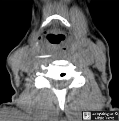 Welcome to LearningRadiology