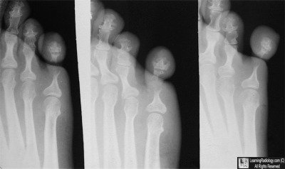 Welcome to LearningRadiology