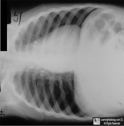 Welcome to LearningRadiology