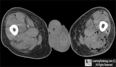 Welcome to LearningRadiology