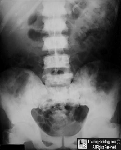 Bone Images (23 of 42)