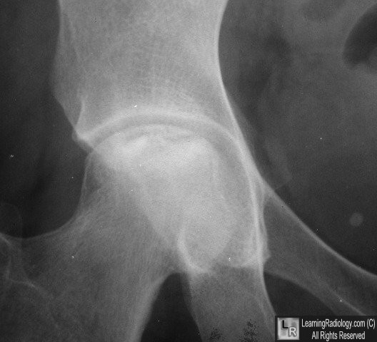 LearningRadiology-MSK Image Gallery