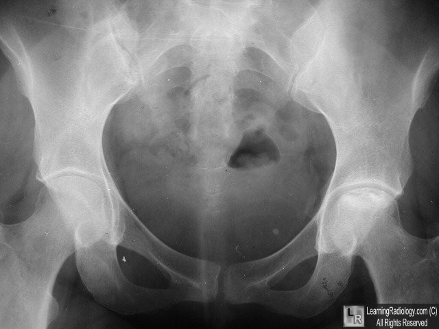 LearningRadiology-MSK Image Gallery