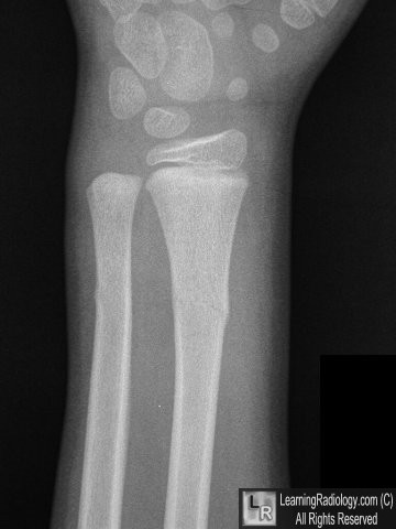 Изображения. КСС. LearningRadiology.com. + | Портал радиологов