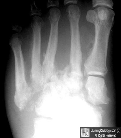 LearningRadiology-MSK Image Gallery