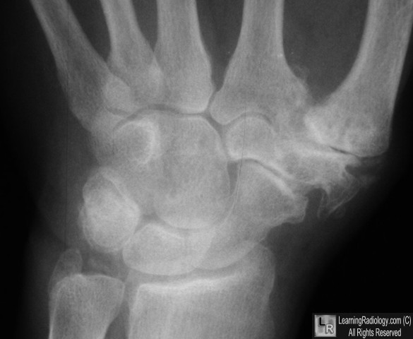 Изображения. КСС. LearningRadiology.com. + | Портал радиологов