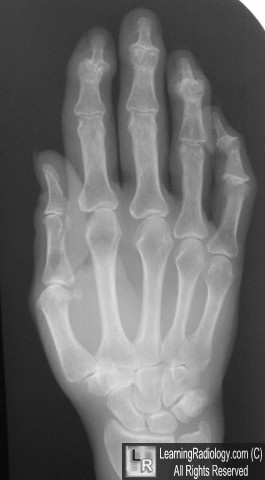 Изображения. КСС. LearningRadiology.com. + | Портал радиологов