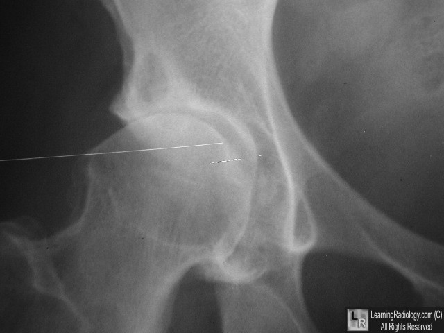 Изображения. КСС. LearningRadiology.com. + | Портал радиологов