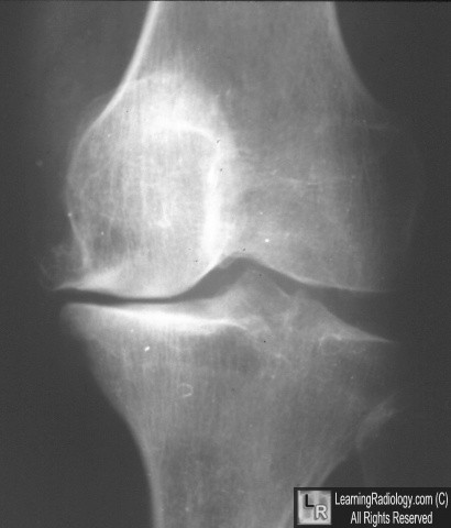 RADIOLOGY, PREGNANCY, INFECTION AND TREATMENT