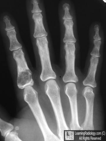 LearningRadiology-MSK Image Gallery
