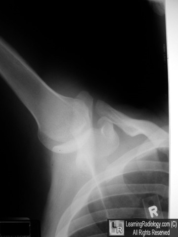 RADIOLOGY, PREGNANCY, INFECTION AND TREATMENT: MSK Image Gallery