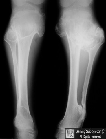 RADIOLOGY, PREGNANCY, INFECTION AND TREATMENT