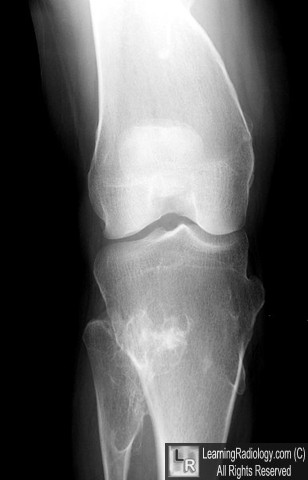 RADIOLOGY, PREGNANCY, INFECTION AND TREATMENT