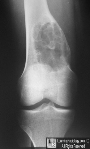 LearningRadiology-MSK Image Gallery