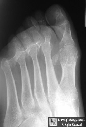 LearningRadiology-MSK Image Gallery