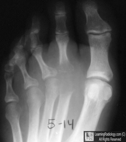 LearningRadiology-MSK Image Gallery