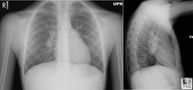 LearningRadiology.com Case of the Week Image Gallery-1