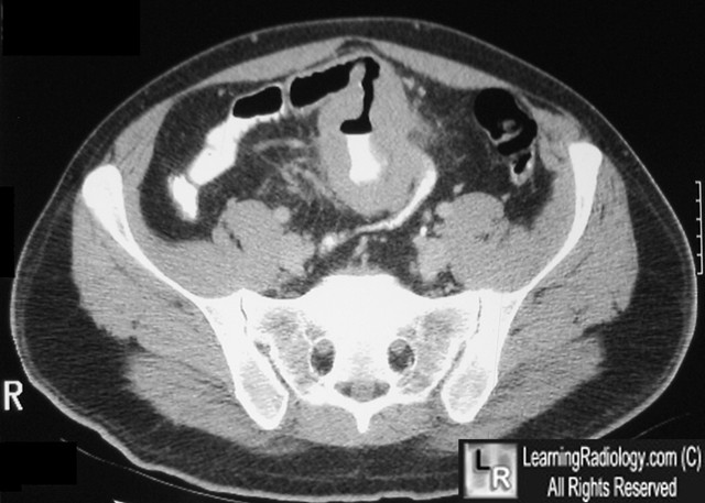 LearningRadiology.com Case of the Week Image Gallery-1