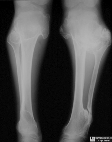 LearningRadiology.com Case of the Week Image Gallery-1