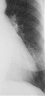 LearningRadiology - ABCs of Heart Disease