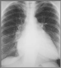 Cardiac Radiology Boards Review