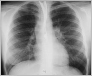 Cardiac Radiology Boards Review