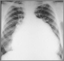 Cardiac Radiology Boards Review