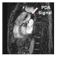 Cardiac Radiology Boards Review