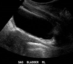 Introduction to Pelvic US-MH