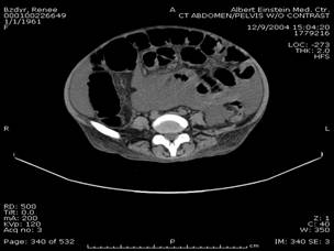 LearningRadiology.com-Abdominal Pain