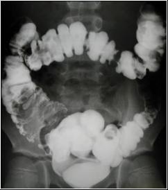 LearningRadiology.com-Acute Abdominal Emergencies