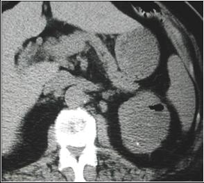 LearningRadiology.com-Flank Pain