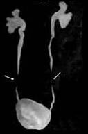 LearningRadiology.com-Basics of Intravenous Urography,IVP,IVU