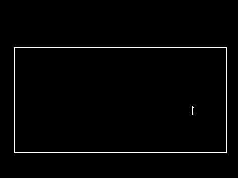 LearningRadiology.com-Basics of Intravenous Urography,IVP,IVU