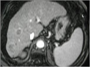 LearningRadiology.com-MRI of Abdomen