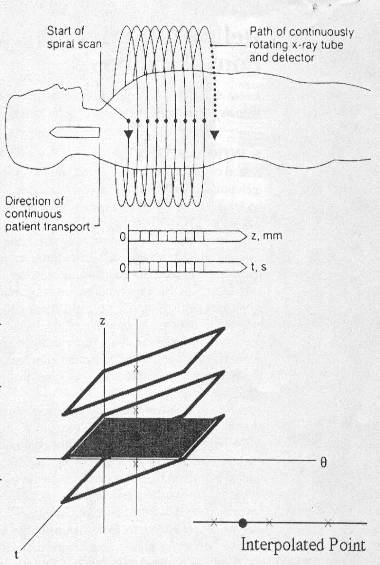 Multi-slice CT: Principles and Perspective