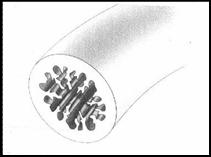 LearningRadiology.com-Imaging in PID, US and CT,pelvic,inflammatory ...