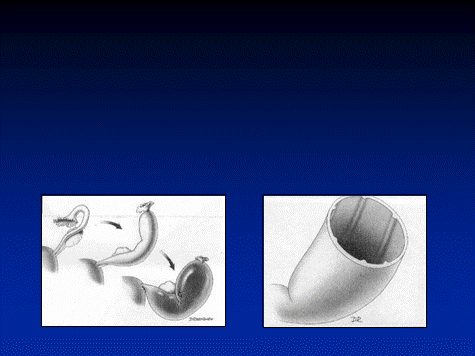 LearningRadiology.com-Imaging in PID, US and CT,pelvic,inflammatory ...