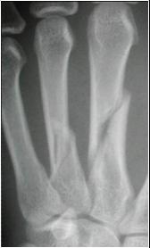 LearningRadiology.com-Skeletal Trauma