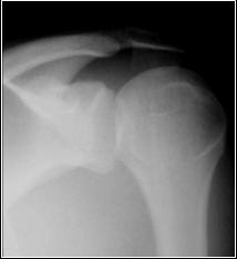 LearningRadiology.com-Skeletal Trauma