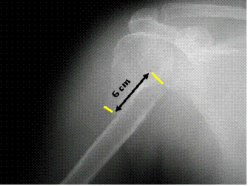 LearningRadiology.com-Skeletal Trauma