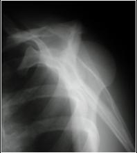 LearningRadiology.com-Skeletal Trauma