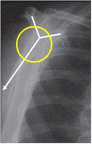 LearningRadiology.com-Skeletal Trauma