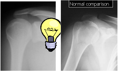 LearningRadiology.com-Skeletal Trauma