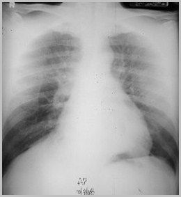 Recognizing Adequate-2012