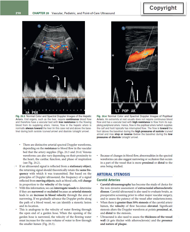 Learning Radiology - Learning Radiology, Recognizing the Basics, 4th ...